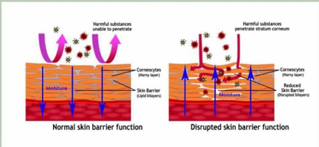 SKIN BARRIER - Talk about Skincare