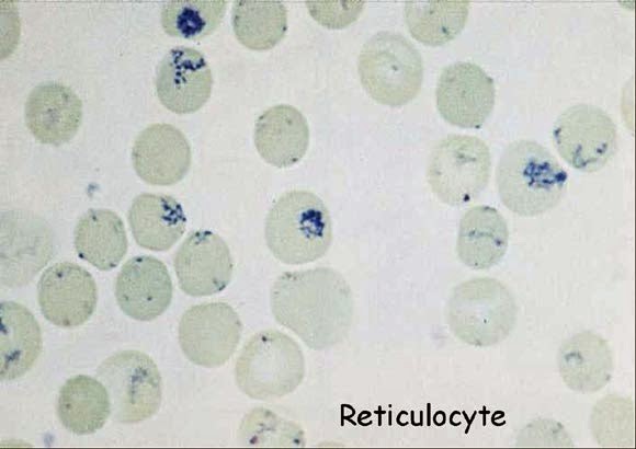 Atlas de Células Sanguíneas : septiembre 2014