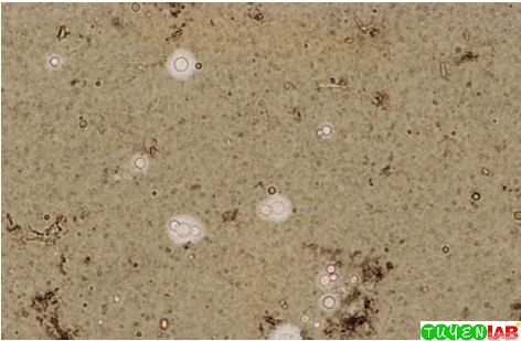 [Parasitology] Atlas of Medically Significant Fungi | Free Medical Atlas