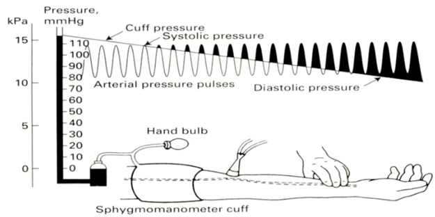 BP Measurement Methods BP Measurement Methods