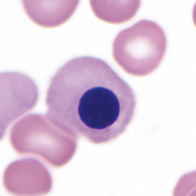 VETERINARY HEMATOLOGY DEXTERVET: orthochromatic normoblast with ...