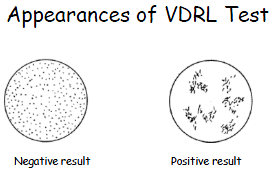VDRL TEST - Microbiology Laboratory Turkey