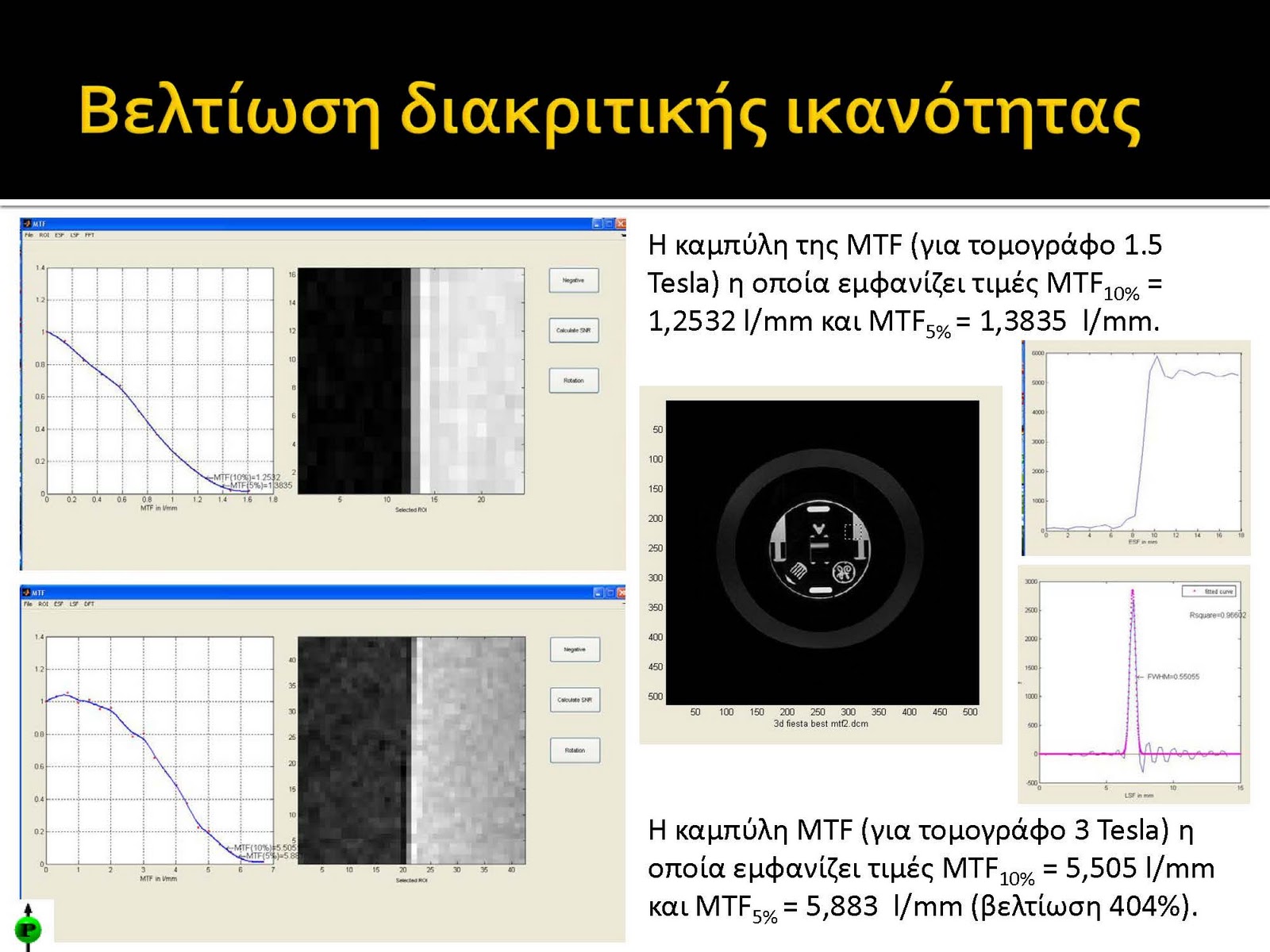 MRI and Medical Imaging: Μαγνητική τομογραφία στα 3 Tesla: εξελίξεις ...