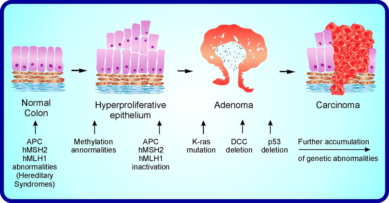 Clinical Cases | Vignettes: Clinical Case: Old Man With Colonoscopic ...