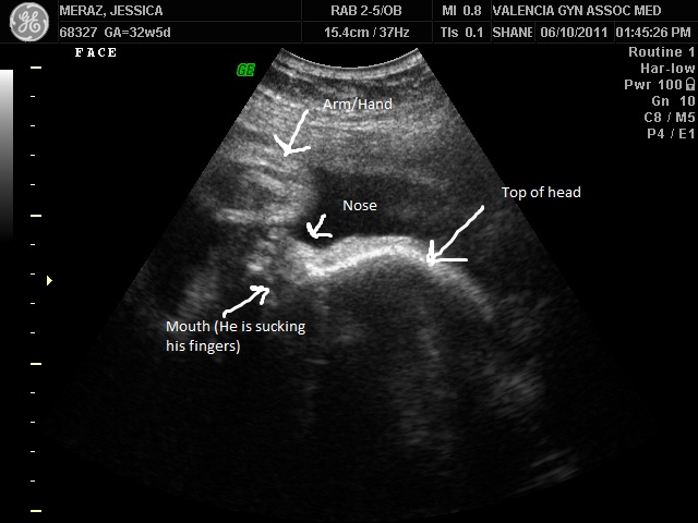Blueberry's Scrapbook: Labeled Ultrasound Pictures