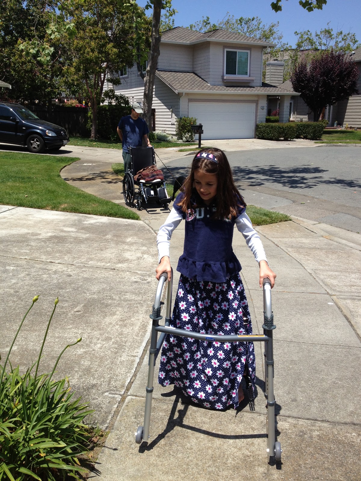 fibular hemimelia leg lengthening: Photos Days 9 and 10