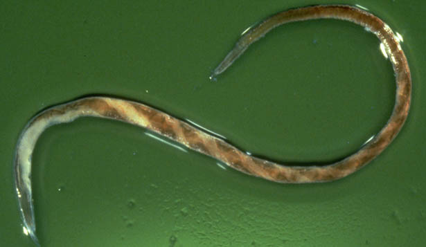 Themes of Parasitology: Haemonchus contortus: A Bite in the Gut