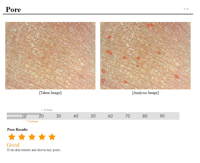 The Beauty Sweet Spot: I Got My Skin Diagnosed!!!!! Find out my Skin ...