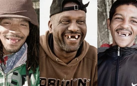 Front Teeth Removal Is Trendy among South African Youth - Stunning ...