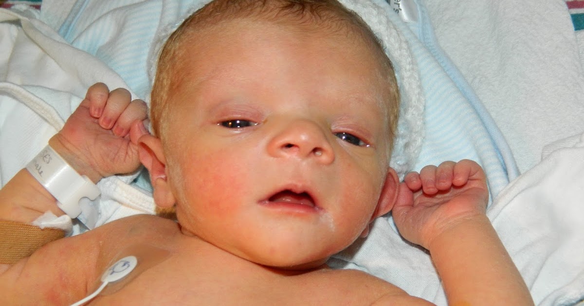 Our Story of a Syndrome:Home from NICU-- Part Six