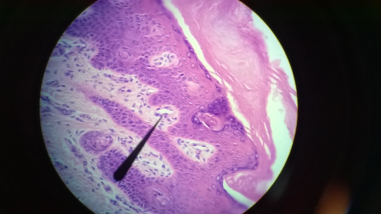 Histología: Tejido Conjuntivo Laxo