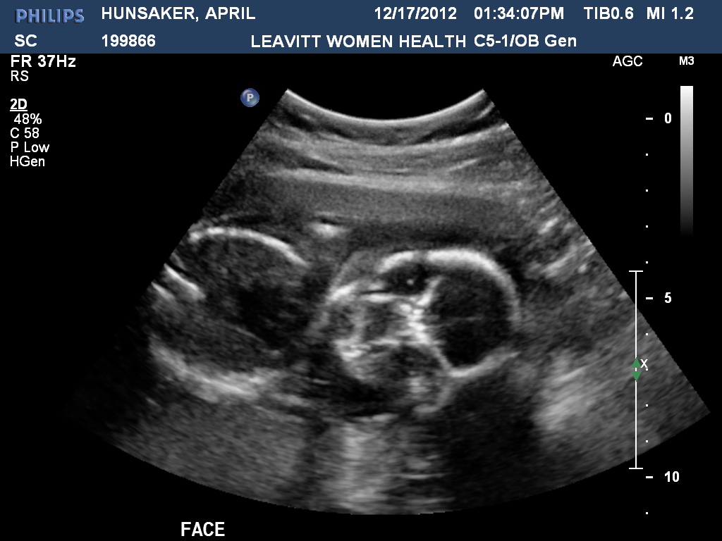 30 week 4d ultrasound - molifuture