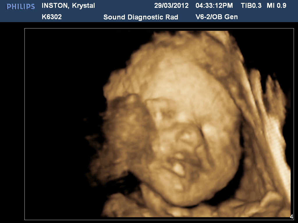 Sam and Krystal: 29 weeks - 3D ultrasound!