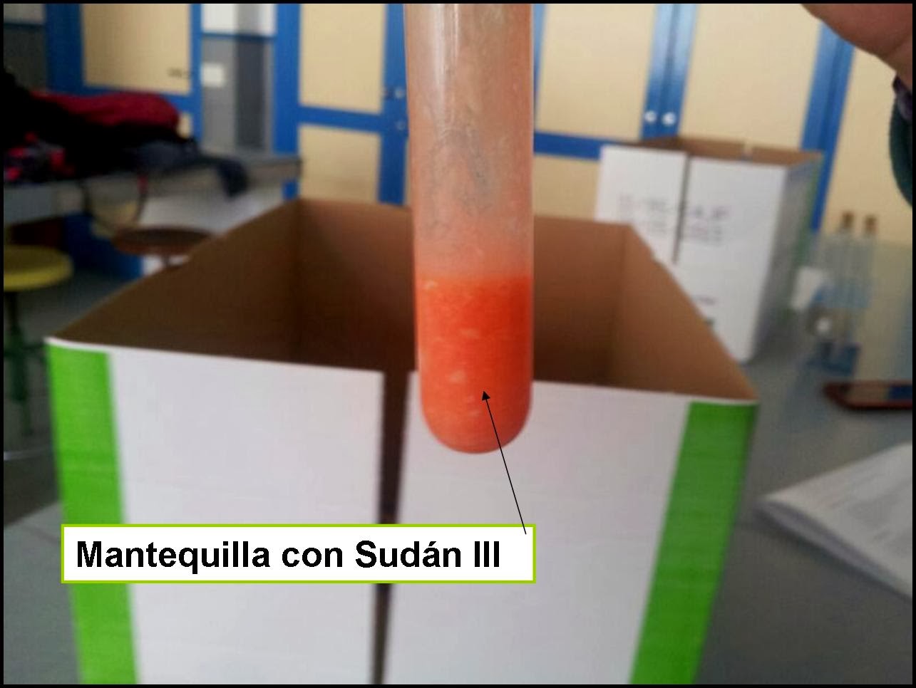 Biología humana: Prueba C. Lípidos. Análisis mediante el reactivo de Sudan III.