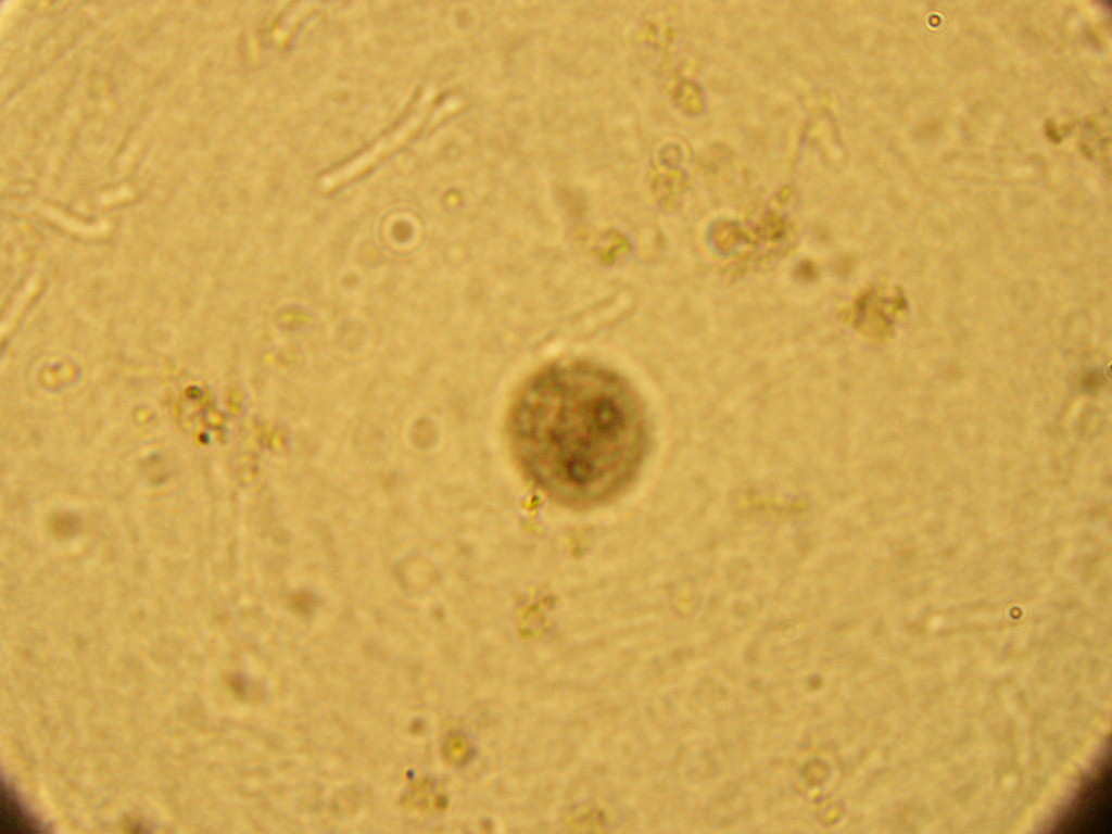 Amebiasis Intestinal: La Respuesta Inmune