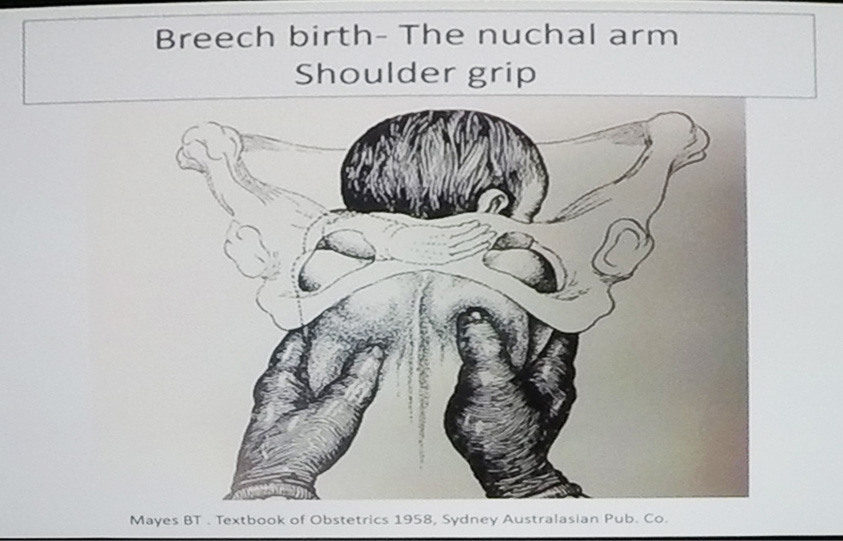 Stand and Deliver: Anke Reitter: New Insights from Pelvimetric MRI ...