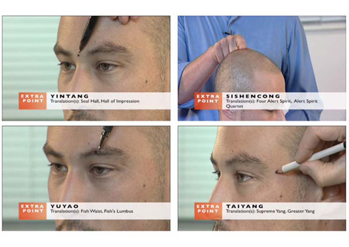 Acupuncture Points Locations - The Extraordinary points | Acupuncture ...
