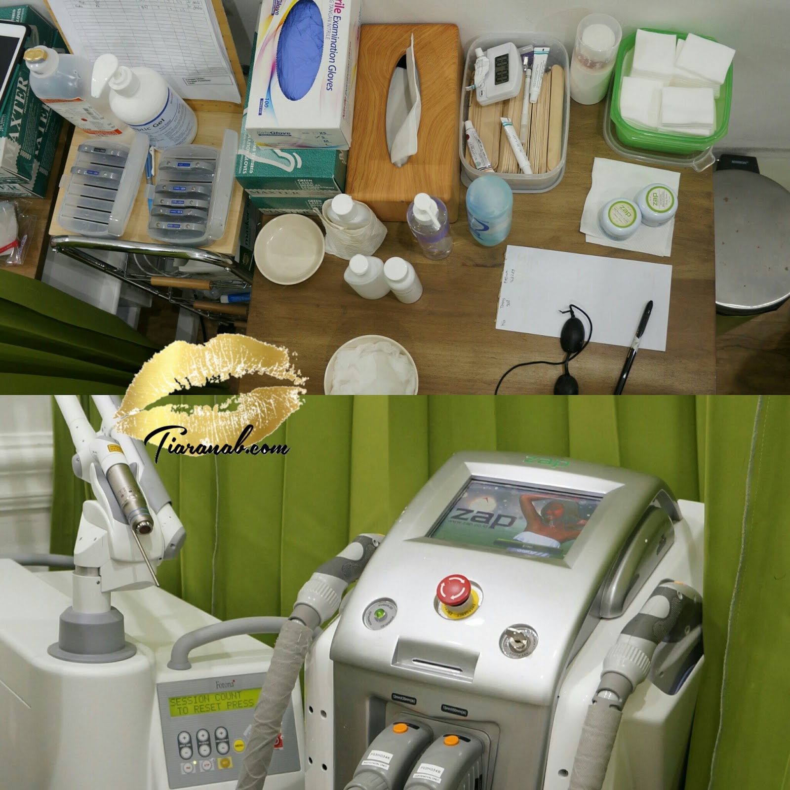 [Beauty Report + Review ] ZAP PREMIER & ZAP Photo Facial Review | Tiaranab