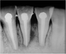 Dentistry and Medicine: Instructions for Surgical Endodontics ...