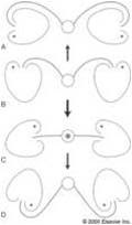Radiologist For Ever: Renal rule 2 : Congenital lesions
