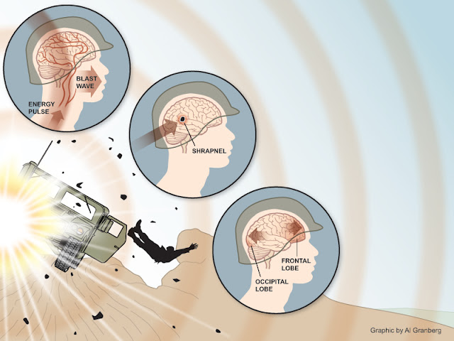 EMS SOLUTIONS INTERNATIONAL by @DrRamonReyesMD marca registrada: Blast ...