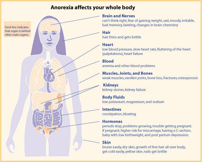 THE SILENT KILLER: ANOREXIA NERVOSA