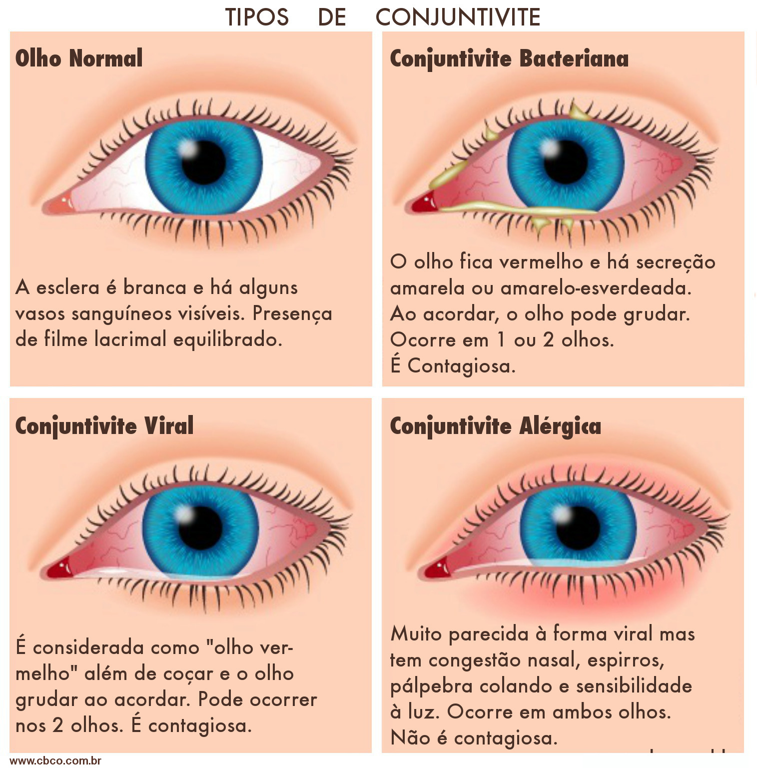 SEM POLEMICA: SECRETARIA MUNICIPAL DE SAÚDE ALERTA SOBRE O SURTO DE ...