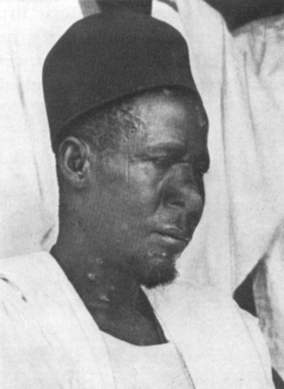 QPath: HISTORY OF YELLOW FEVER: OPENING OF PANAMA CANAL TO ONLY NOBEL ...