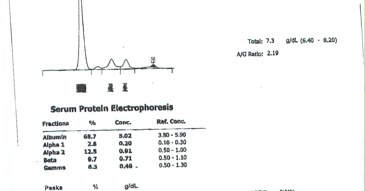 jm's Adventure with Multiple Myeloma: SPEP - M-Spike Values from ...
