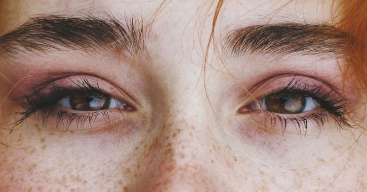 7 Weird Things You Never Knew About Freckles