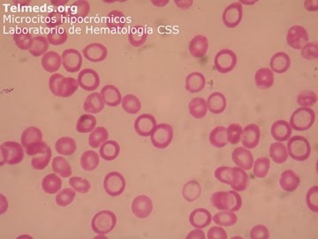 HEMATOLOGÍA: Serie Roja