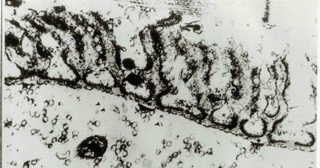 Atlas Histológico UNIFOR-MG: Placa motora