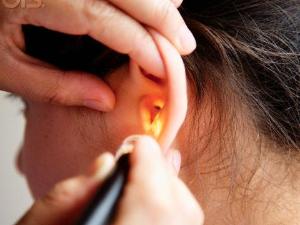 Ayo Buka Wawasan Kita !!!: Serumen Prop