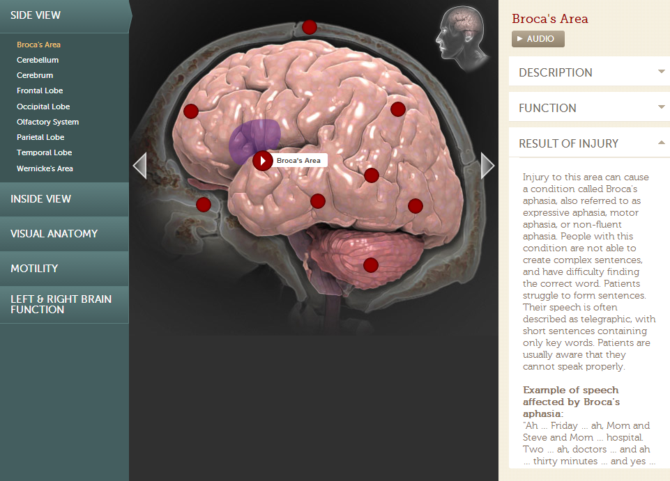 BRAIN-COMPUTER INTERFACES over EEG: Interactive Brain Injury