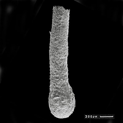 Catalogue of Organisms: Hyperamminids: A Rough Retort