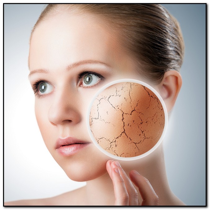 10 Best Moisturizer For Dry Acne Prone Skin - SKIN PROBLEMS