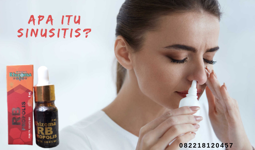 Apa itu Sinusitis, Penyebab Sinusitis, dan Gejala Sinusitis - manfaat ...