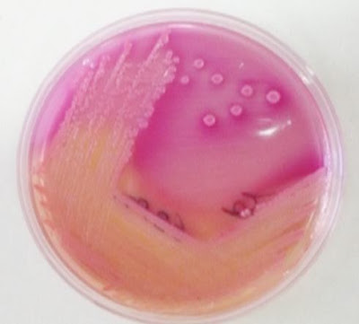 ENTEROBACTER SPP. - Microbiology Laboratory Turkey