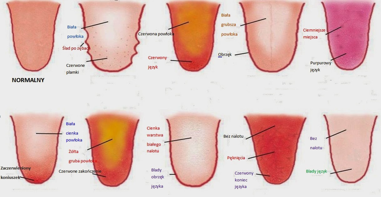 A choroby wyczytasz z języka... | Diety i ich sekrety