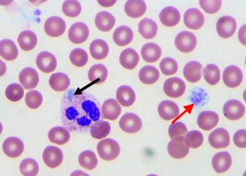 Lecture Notes in Medical Technology: Lecture #9 : The White Blood Cells