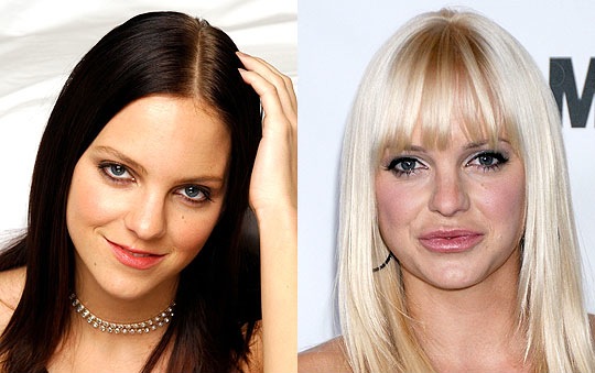Anna Faris Plastic Surgery