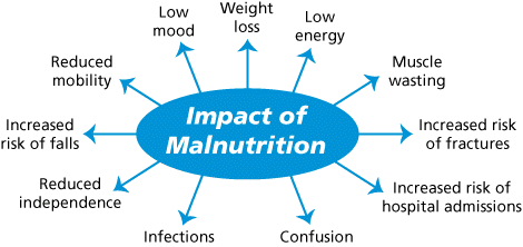 MALNUTRITION RISING GLOBAL NUTRITION REPORT