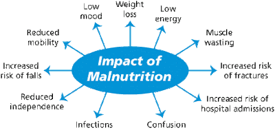 MALNUTRITION RISING GLOBAL NUTRITION REPORT