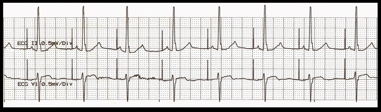 Practice EKG Strips 359