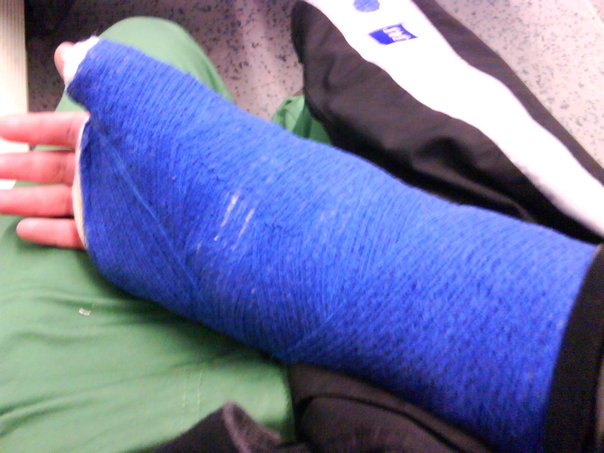 Min tur, jag kan!: Pimp my cast!