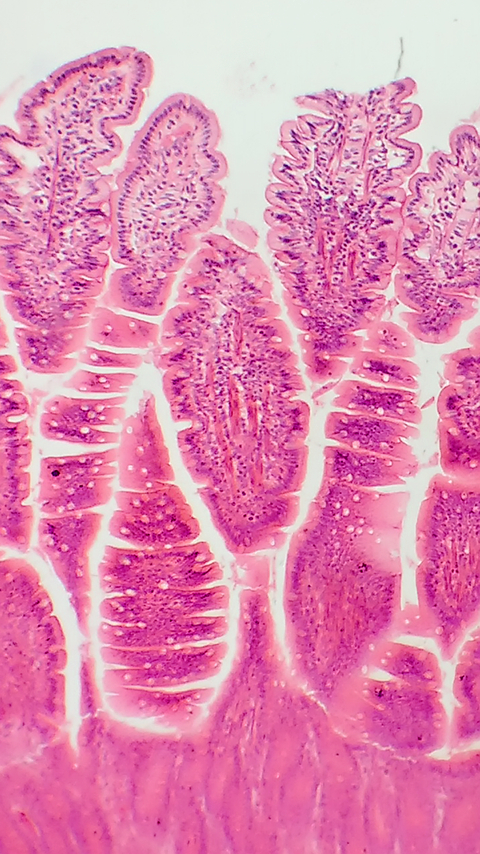 Epitélio simples cilíndrico com microvilosidades e células caliciformes