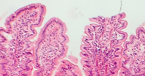 Epitélio simples cilíndrico com microvilosidades e células caliciformes