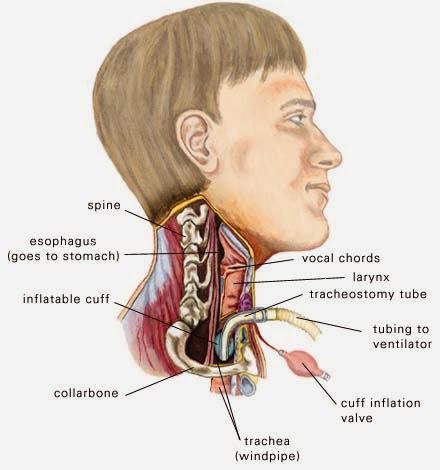 The Site That Breathes: Trach 101