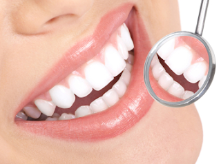 Periodontal Associates - Dental Implant Team : Artificial Enamel