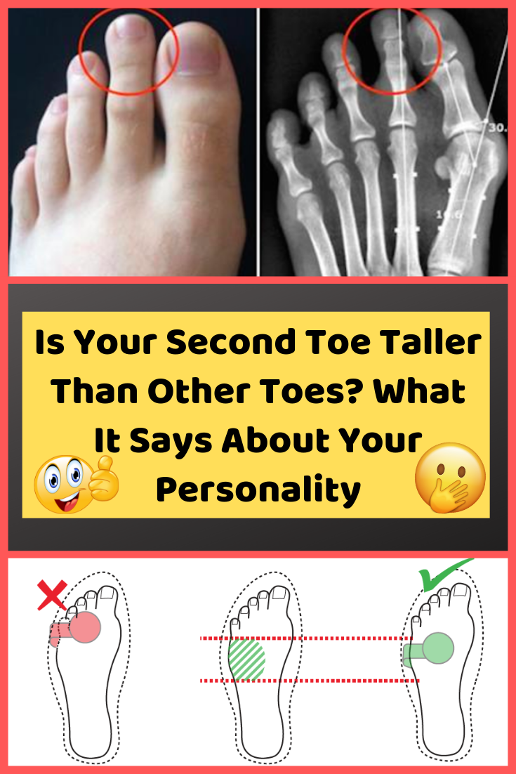 Is Your Second Toe Taller Than Other Toes? What It Says About Your ...